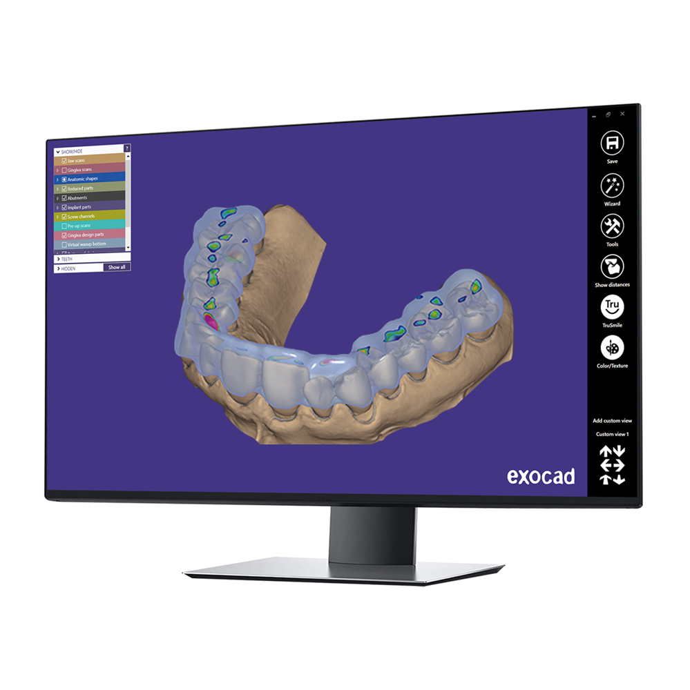 exocad 3.3 Chemnitz - Try Before You Buy | Dental Digital Design